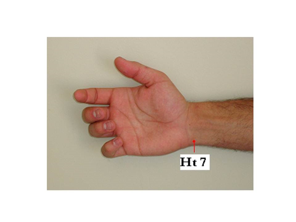 THE TOP FIVE ACUPUNCTURE POINTS FOR INSOMNIA | Princeton Acupuncture ...