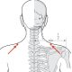 Top 5 Acupuncture Points for Shoulder Pain | Princeton Acupuncture And ...
